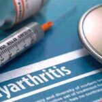 Polyarthritis: Symptoms, Causes, Treatments and More