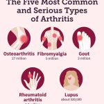 Everything You Need To Know About Knee and Hip Joint Pain